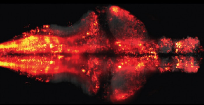 How Do Different Brain Regions Interact to Enhance Function?