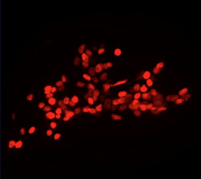 Capturing the Whole Brain in Action