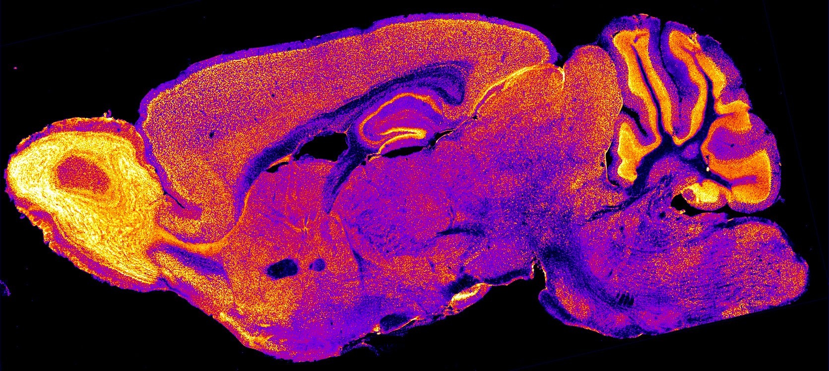 SFARI Research Roundup