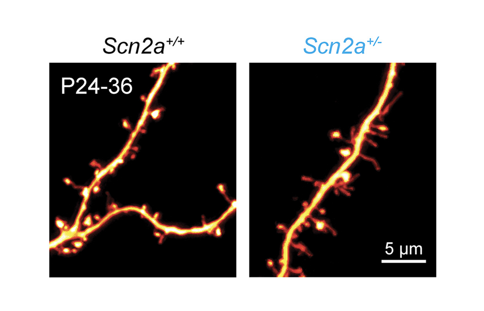 SFARI | Unexpected synaptic role for the autism risk gene Scn2a