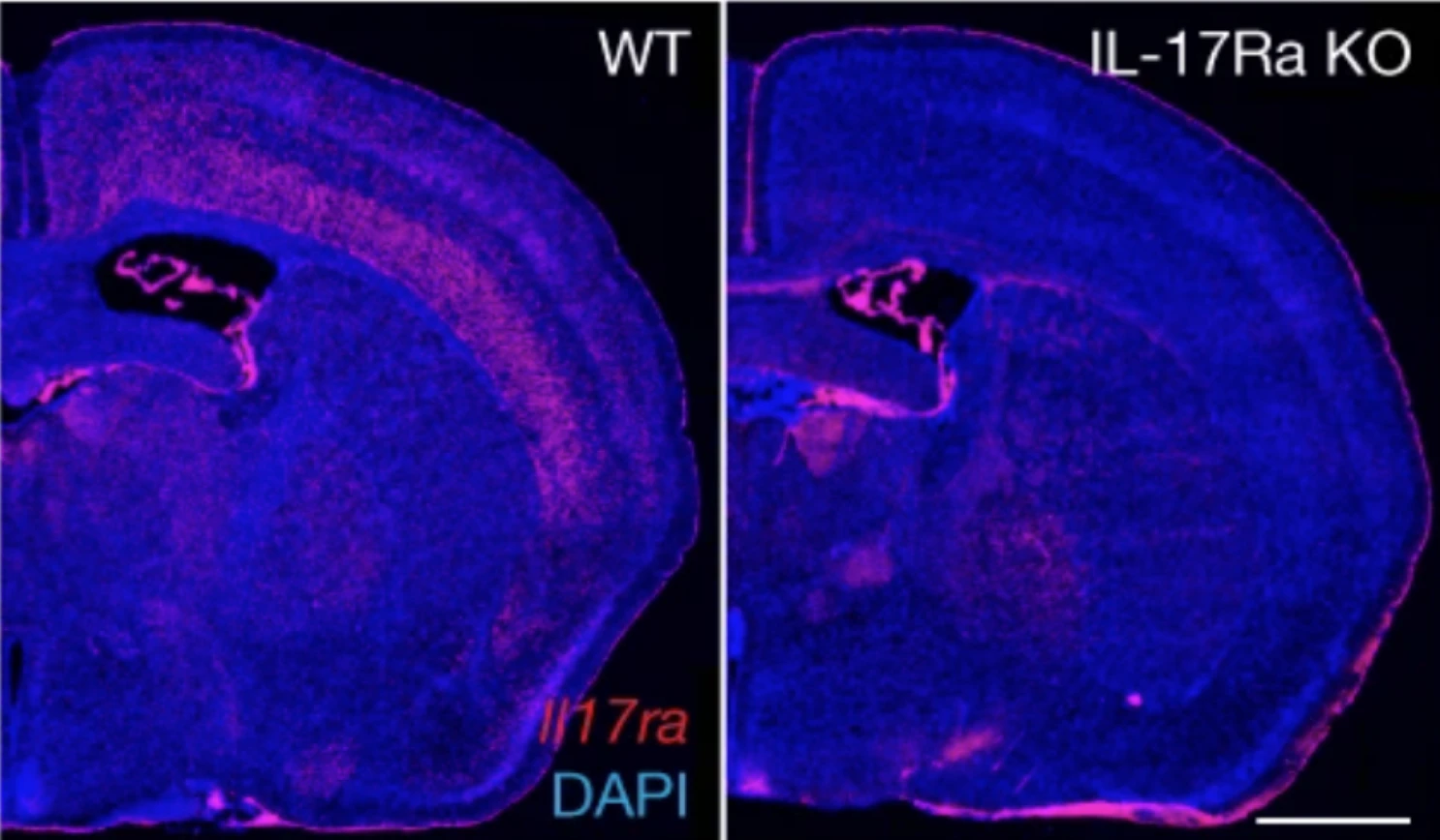 SFARI | Neuroimmune mechanisms in autism mouse models