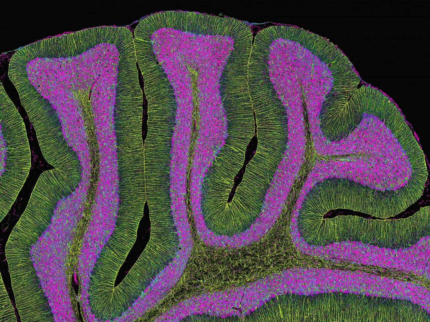 SFARI | Analysis of Postmortem Brain Tissue from the Autism BrainNet ...