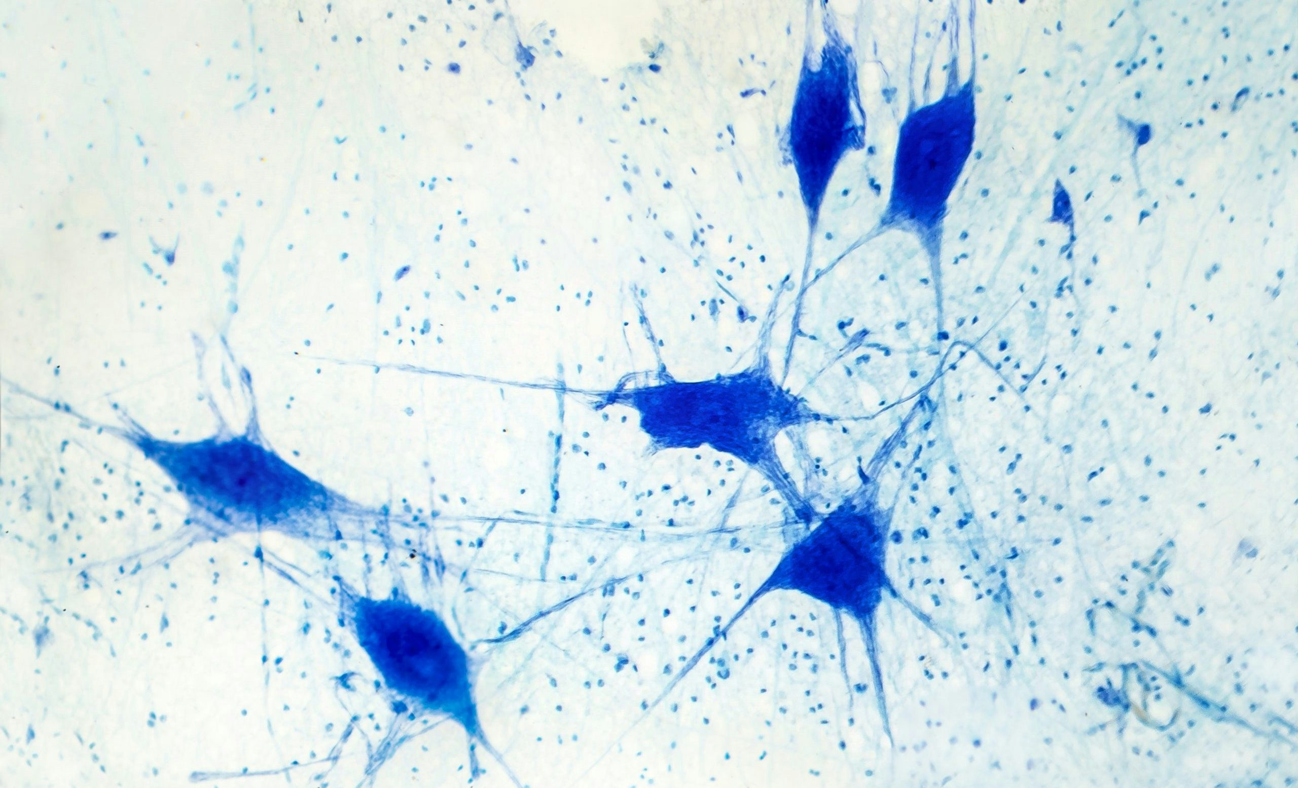 SFARI | Analysis of Autism BrainNet postmortem brain tissue RFA ...