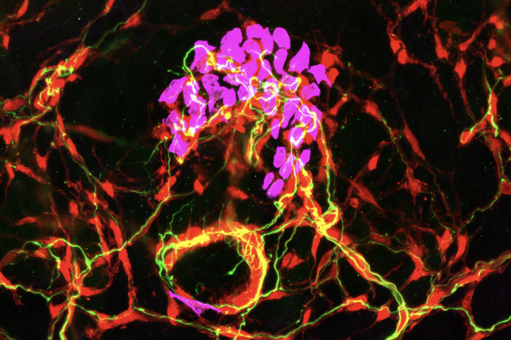 SFARI | Approaches for measuring sensory function in ASD/NDD