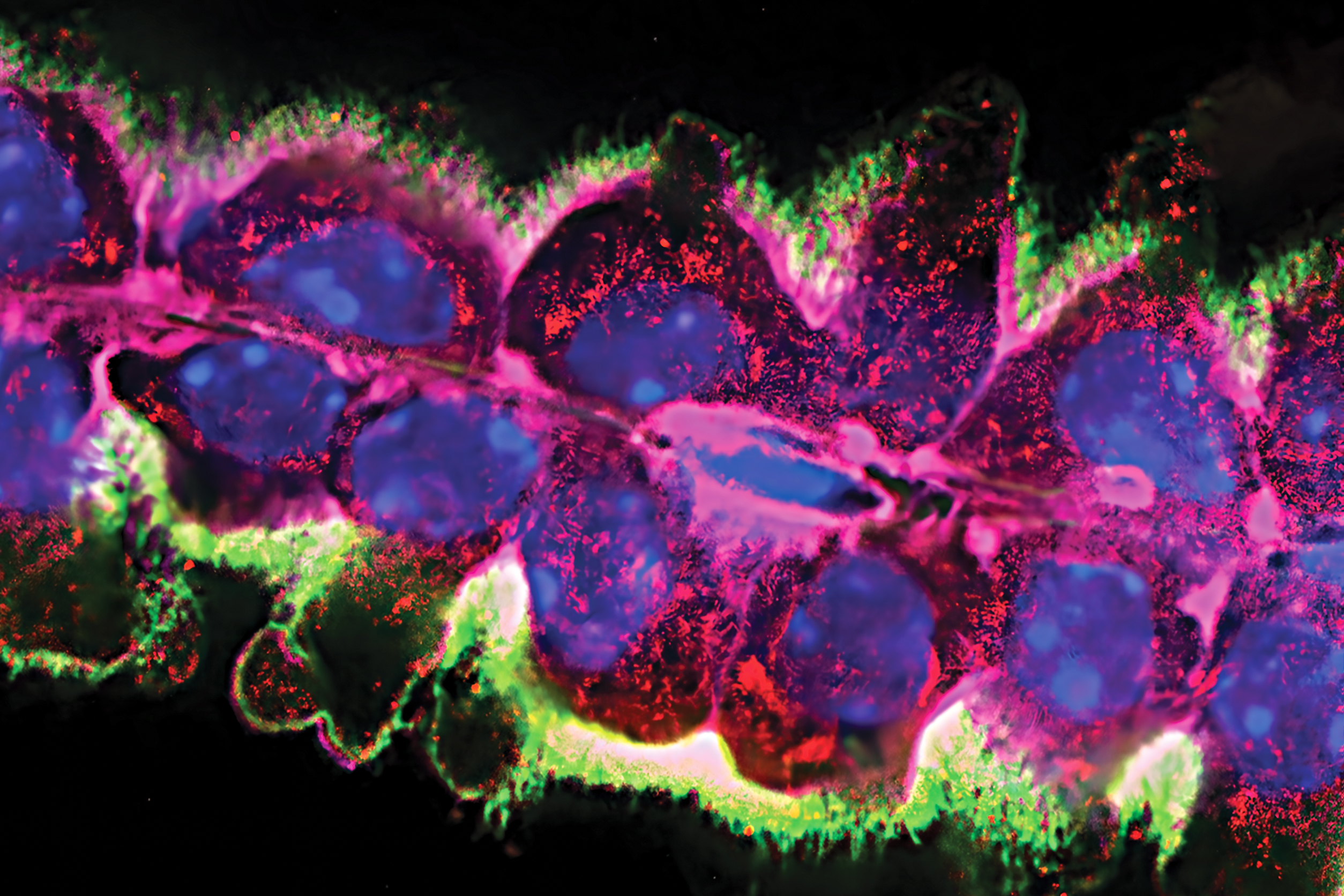 SFARI | Choroid Plexus Secretion Regulates CSF Proteome and Alters ...